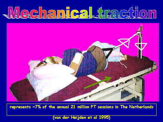 Neurophysiological effects of spinal mechanical traction ...